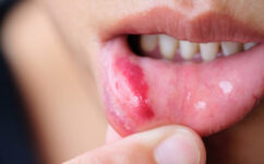 ¿Qué causa el tono morado en los labios?